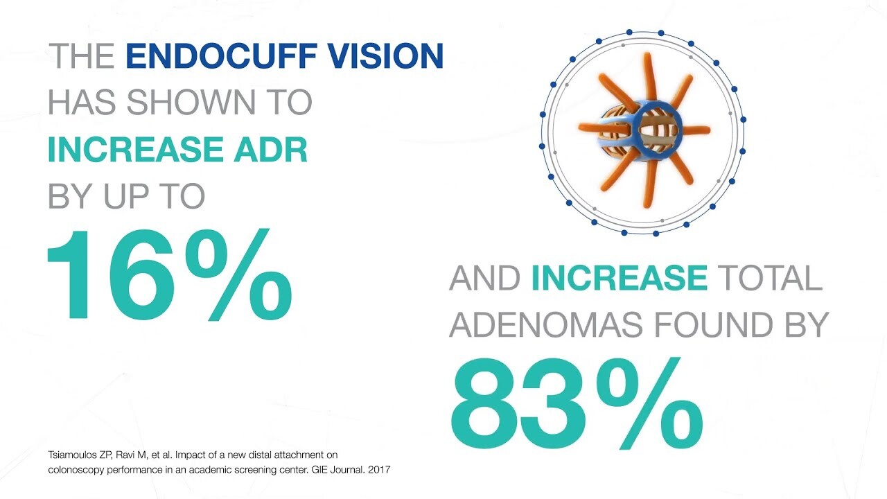 ArtStation - ENDOCUFF VISION Clinical Overview | 2017 Work