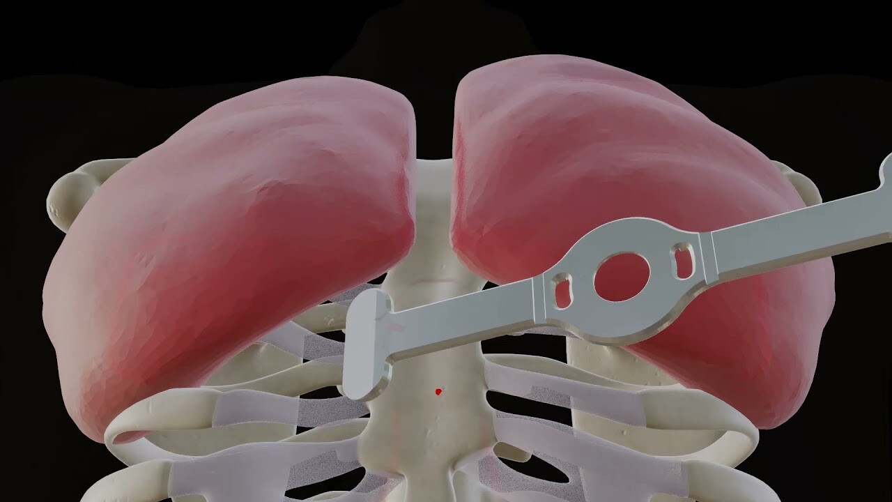 ArtStation - Torax Medical Animation