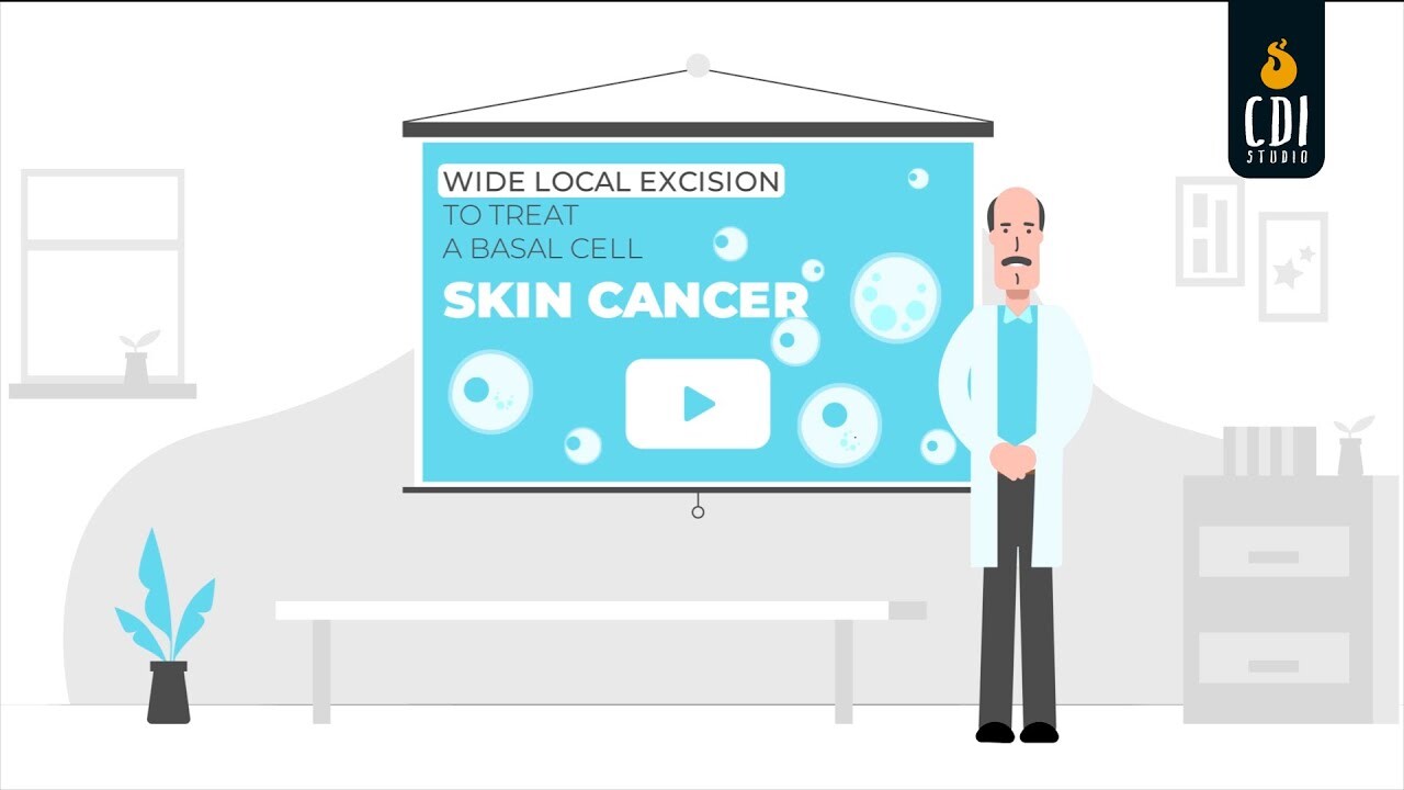 ArtStation - 2D Explainer Style Animation of Basal Cell Skin Cancer