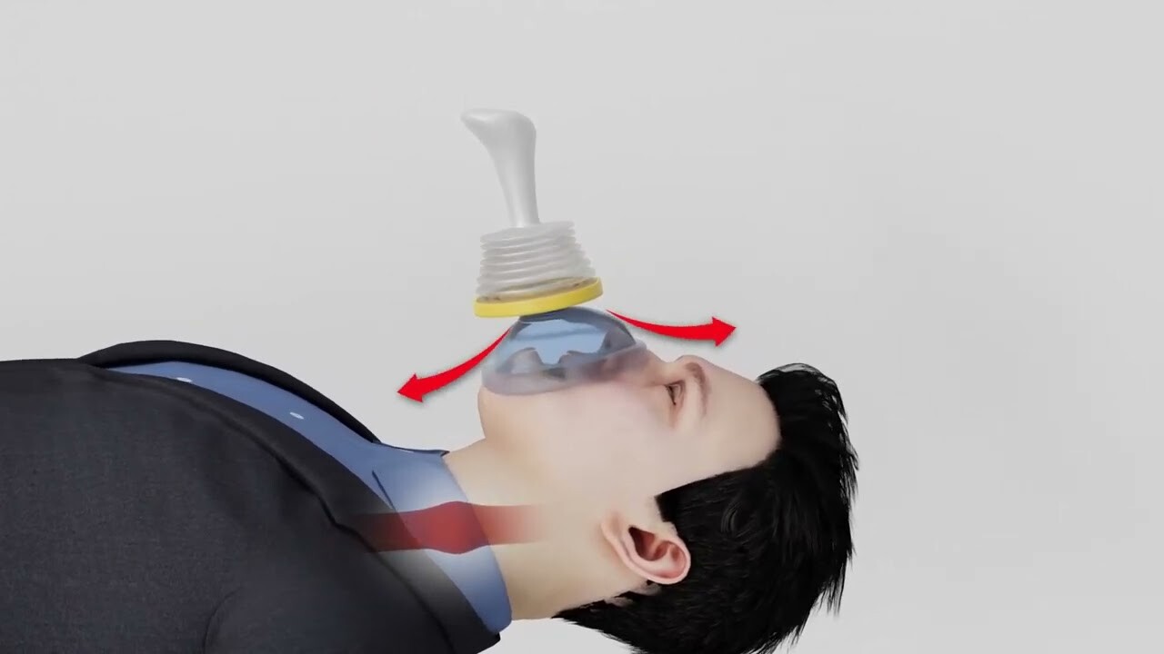 ArtStation - More animations of the Heimlich Device