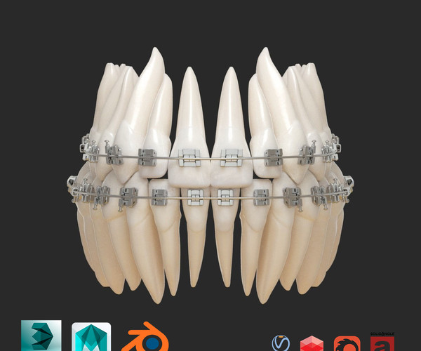 ArtStation - Teeth 3D Print and Render. | Resources