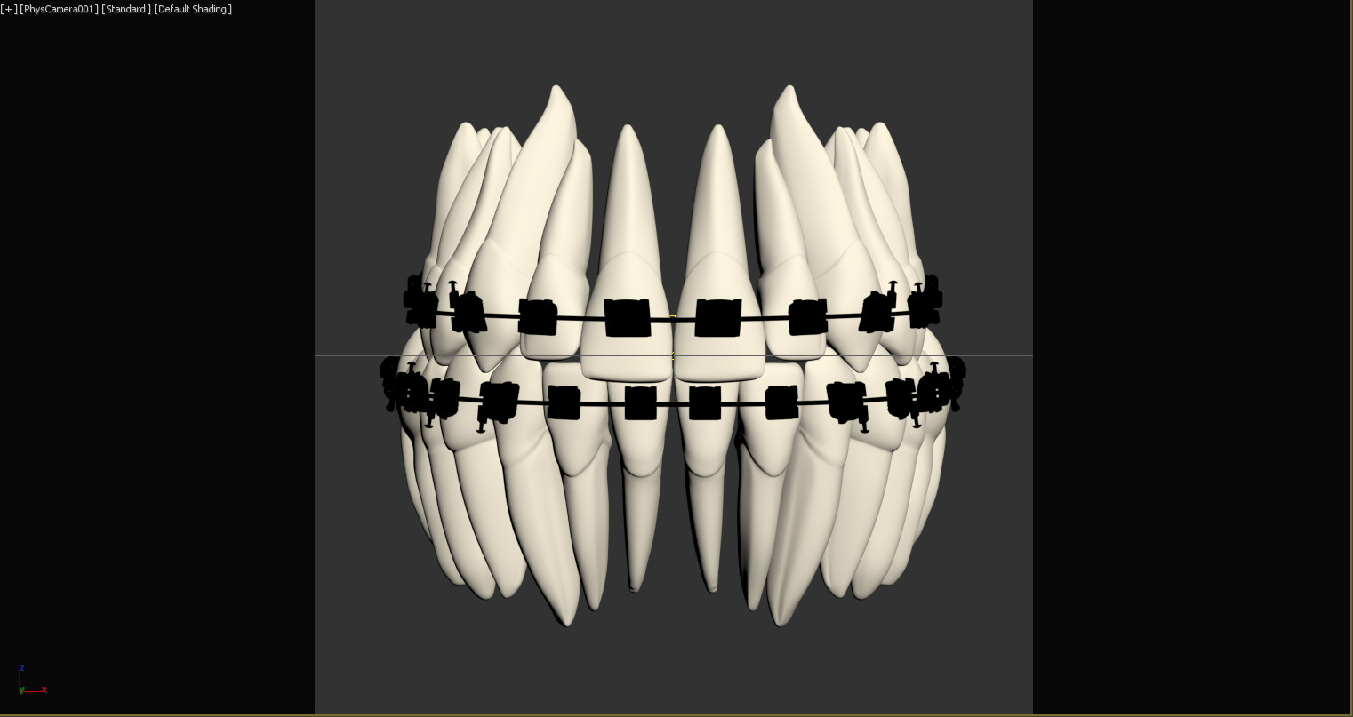 ArtStation - Teeth 3D Print and Render. | Resources