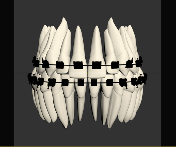 ArtStation - Teeth 3D Print and Render. | Resources