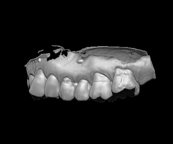 ArtStation - FEMALE MAXILA | Resources