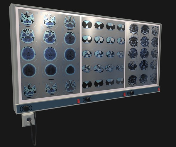 ArtStation - screen x ray film viewer | Resources