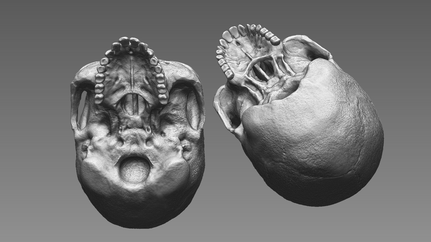 ArtStation - Human Realistic Skull | High Poly | Resources