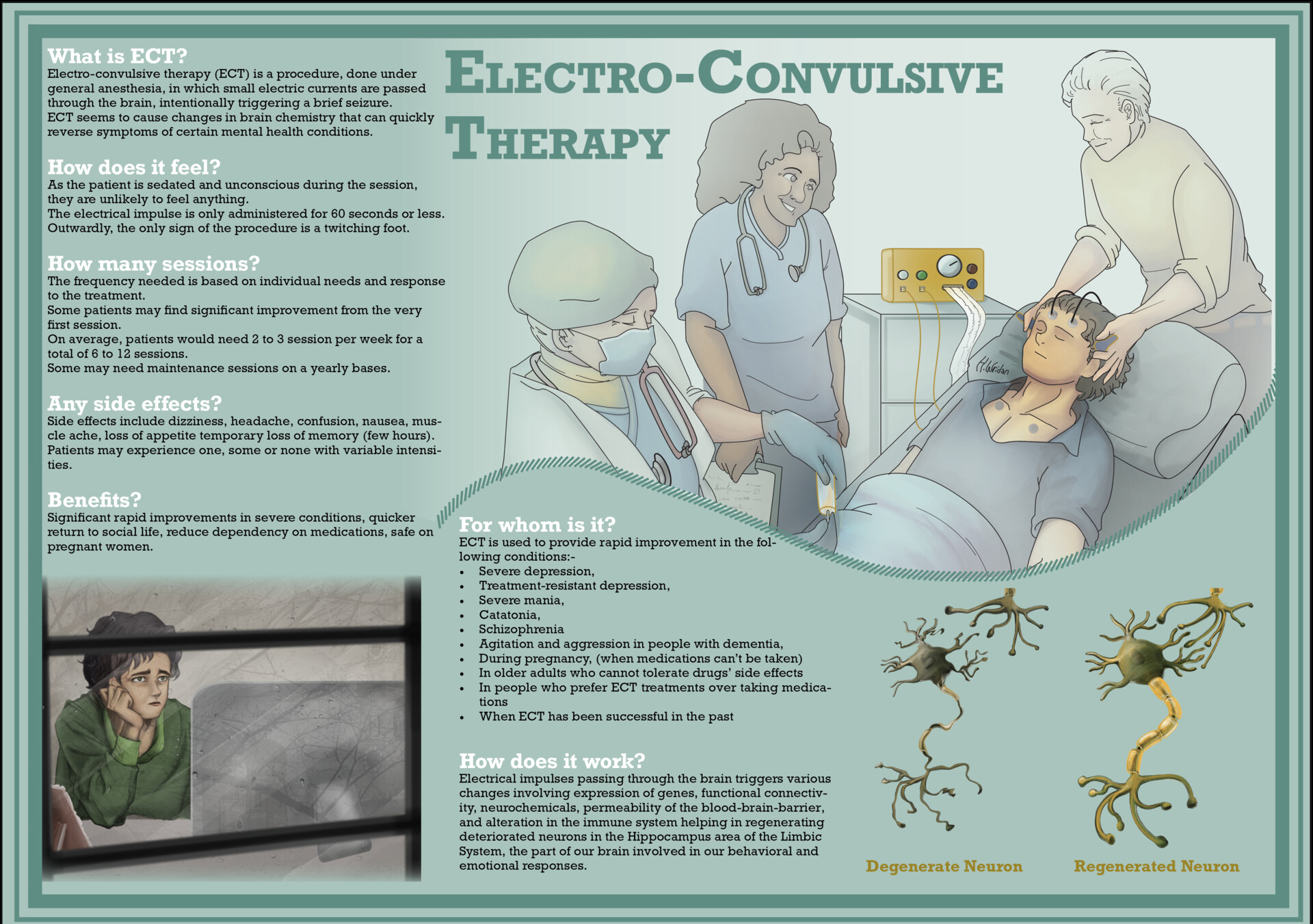 H.Wridan Scientific Illustrations - Electro-convulsive Therapy: 4 ...